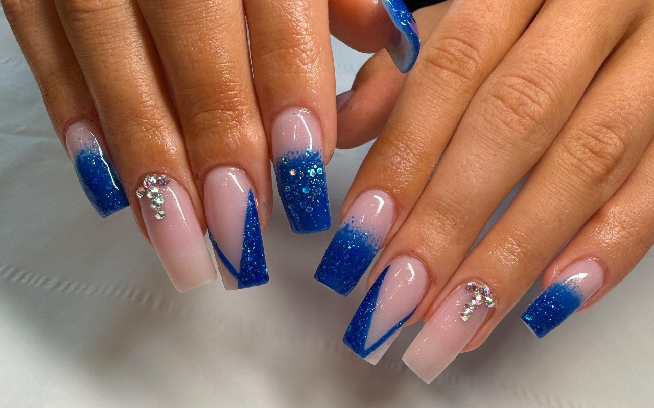 Mole/Cyst Removal in Newcastle-under-Lyme, Staffordshire - Treatwell